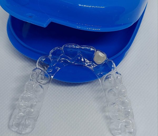 Essix Partial Denture Retainer: Pros, Cons, And Cost