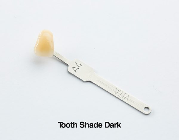 Nesbit Flexible Partial Denture – Dental Lab Direct