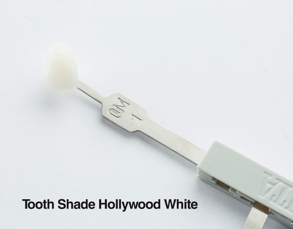 Nesbit Flexible Partial Denture – Dental Lab Direct