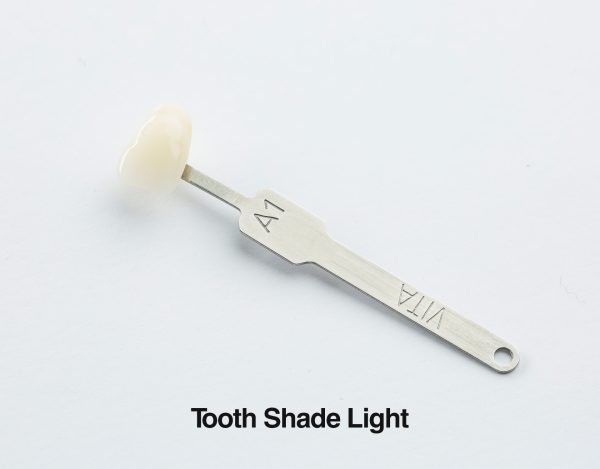 Nesbit Flexible Partial Denture – Dental Lab Direct