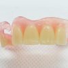 Flexible Partial Dentures – Dental Lab Direct