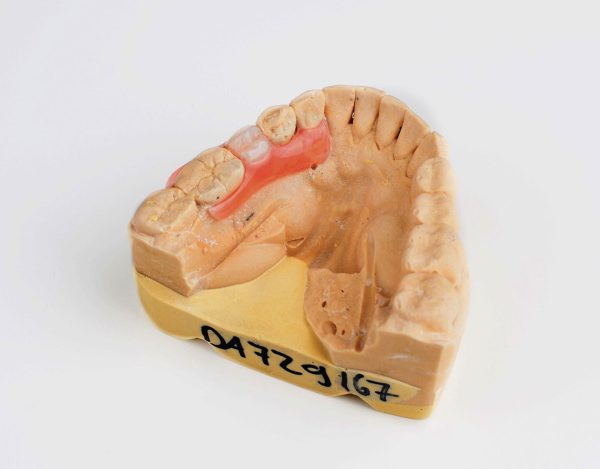 Order Nesbit Flexible Partial Denture | Dental Lab Direct