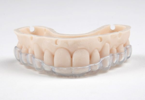 Custom-Made Hard Nightguard - Dental Lab Direct