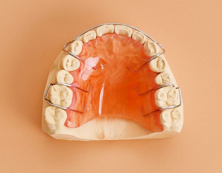 Hawley Retainers | Dental Lab Direct