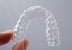 What is an Essix Appliance? - Dental Lab Direct