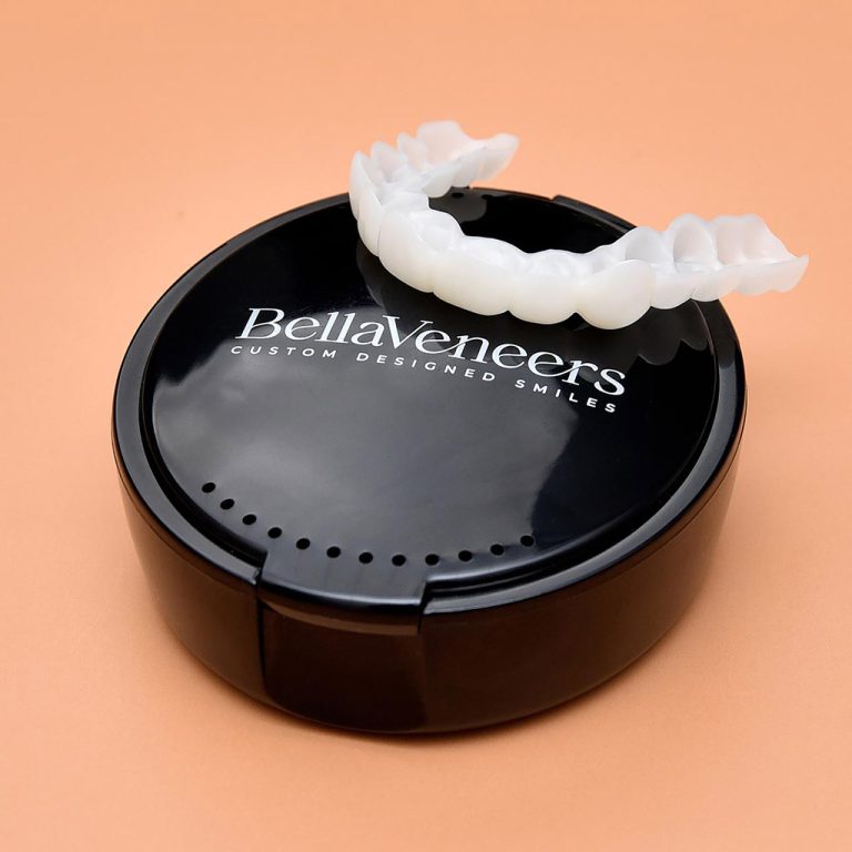 Everything You Need To Know About Nesbit Partial Dentures