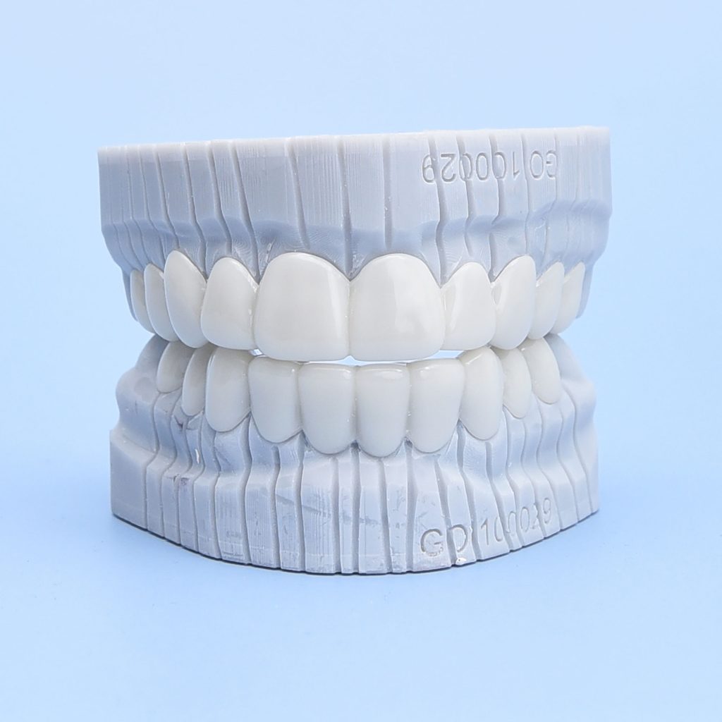 Essix Partial Denture Retainer: Pros, Cons, and Cost - Dental Lab Direct