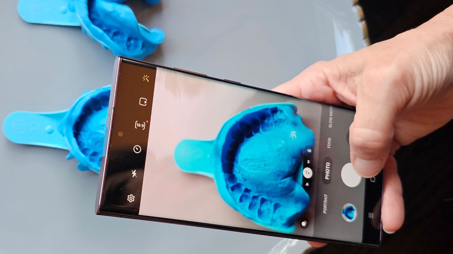 Everything You Need To Know About Nesbit Partial Dentures