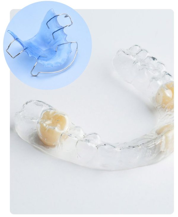 Hawley Retainers | Dental Lab Direct